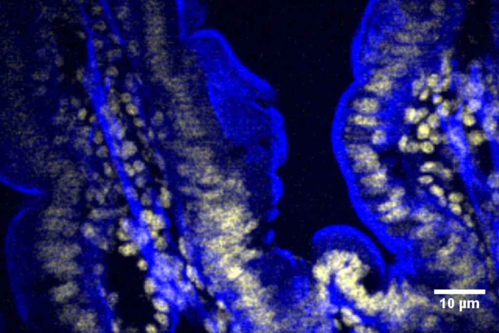 Cyclone: Fiber Laser - Femtosecond Laser | FYLA